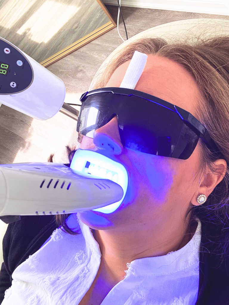 I TRIED PROFESSIONAL TEETH WHITENING - HERE'S HOW IT WENT | Renee ...